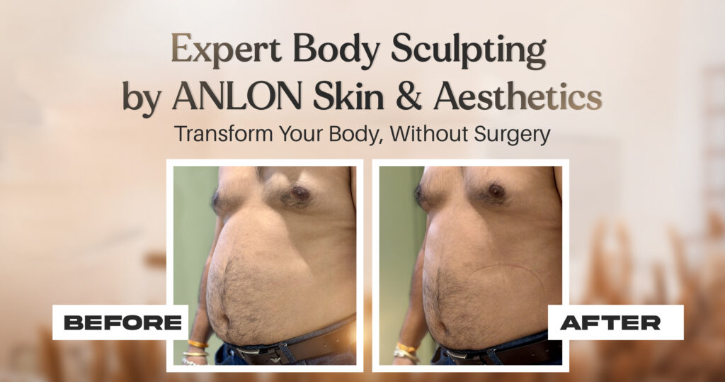 Body Sculpting at ANLON Skin & Aesthetics - Anlon Art Salon